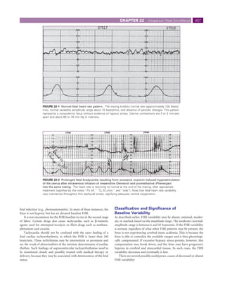 4 u1.0-b978-1-4160-4224-2..50024-7..docpdf | PDF