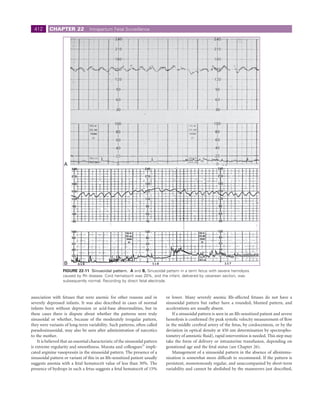 4 u1.0-b978-1-4160-4224-2..50024-7..docpdf | PDF