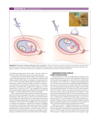 4 u1.0-b978-1-4160-4224-2..50026-0..docpdf | PDF