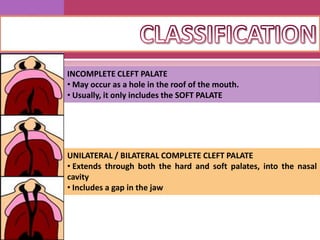 4. virola cleft palate | PPT