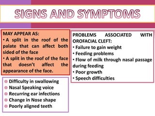4. virola cleft palate | PPT