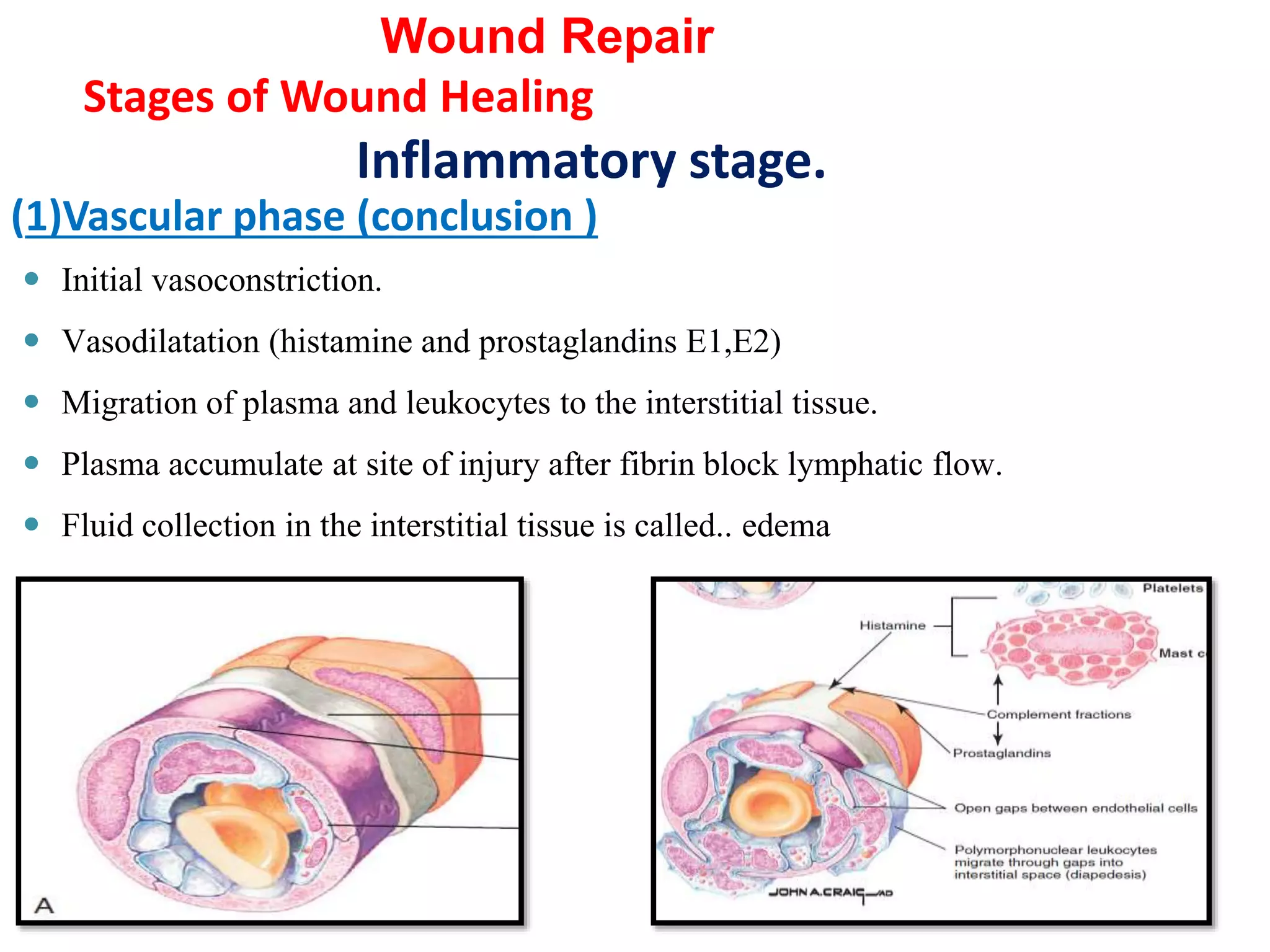 wound repair | PPTX