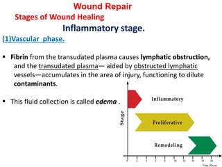 wound repair | PPTX
