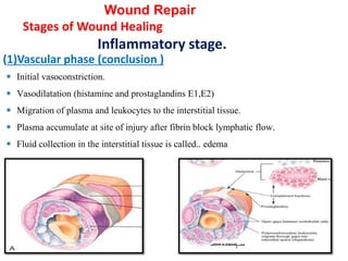 wound repair | PPTX