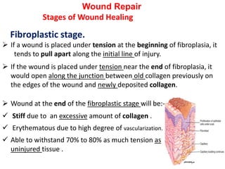 wound repair | PPTX