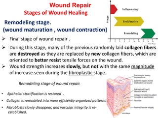 wound repair | PPTX