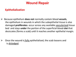 wound repair | PPTX