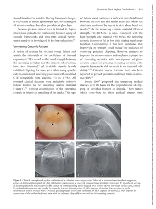 4 - Zirconia in fixed implant prosthodontics.pdf