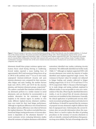 4 - Zirconia in fixed implant prosthodontics.pdf
