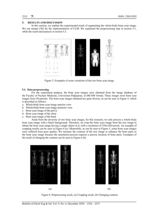 Automatic whole-body bone scan image segmentation based on constrained ...
