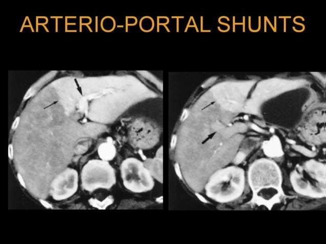 40-Dr Ahmed Esawy imaging oral board of liver part IV hepatic ...