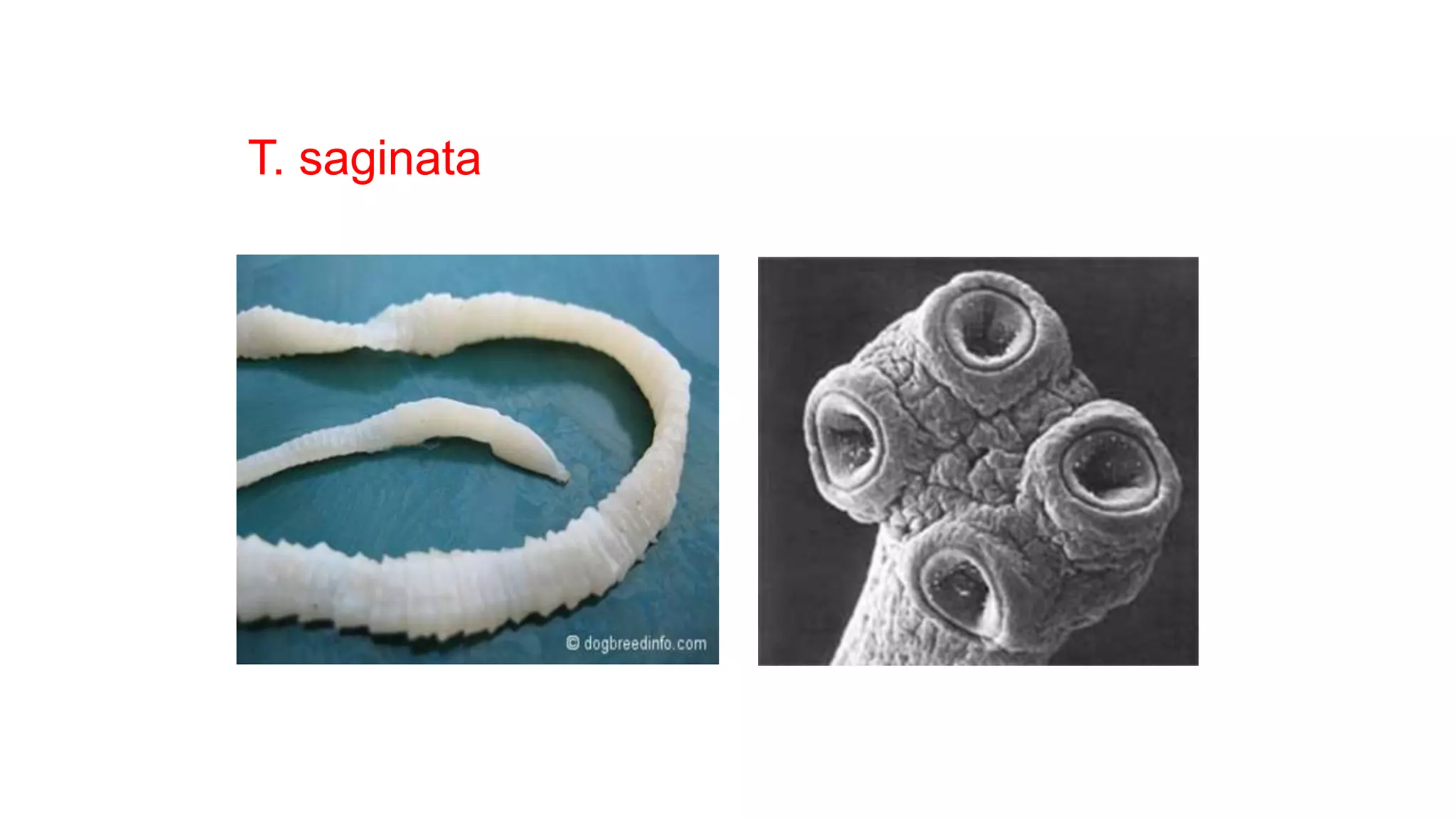 40-Tinea saginata.pptx