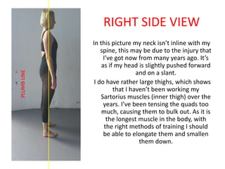 Posture Analysis | PPTX