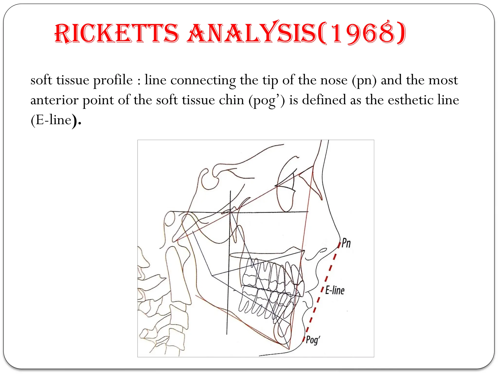 403138990-Soft-Tissue-Ppt-Sneha in orthodontics | PPTX