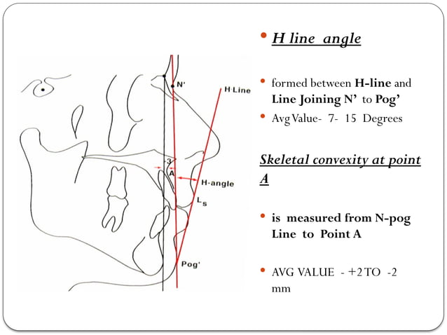 403138990-Soft-Tissue-Ppt-Sneha in orthodontics | PPT