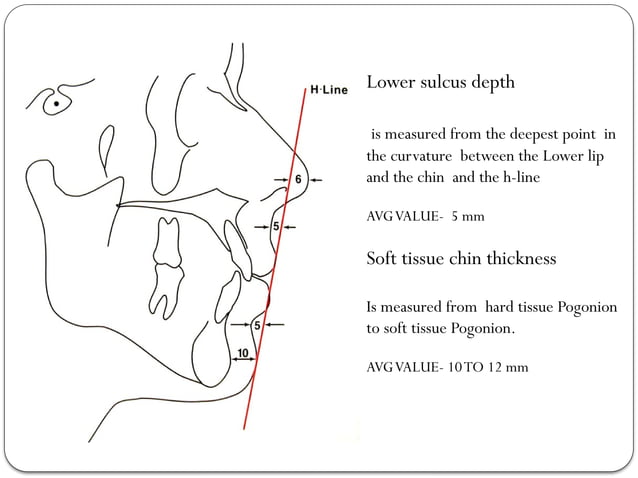 403138990-Soft-Tissue-Ppt-Sneha in orthodontics | PPT
