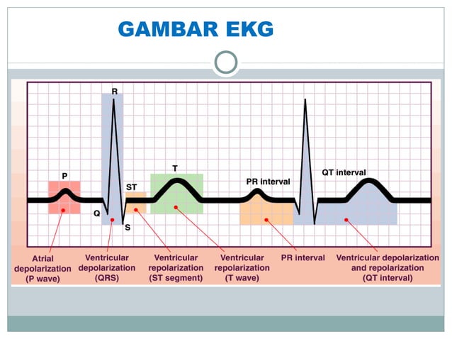 pengenalan-ekg-pati-ppt | PPT