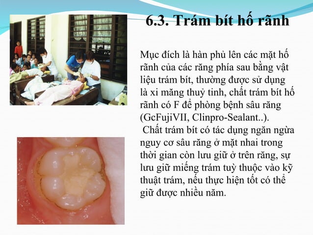 Bài Tuyên Truyền Chăm Sóc Sức Khỏe Răng Miệng Cho Học Sinh | PDF
