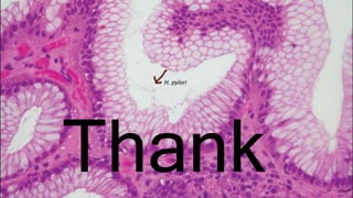 40513175_ebh 2023_MIC09800_helicobacter pylori ppt..pptx