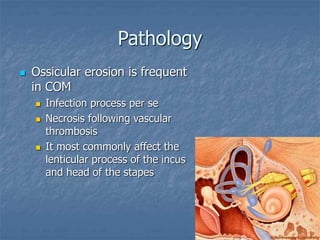 (Com) Chronic otitis media (com).ppt | Ear, Nose and Throat Conditions ...