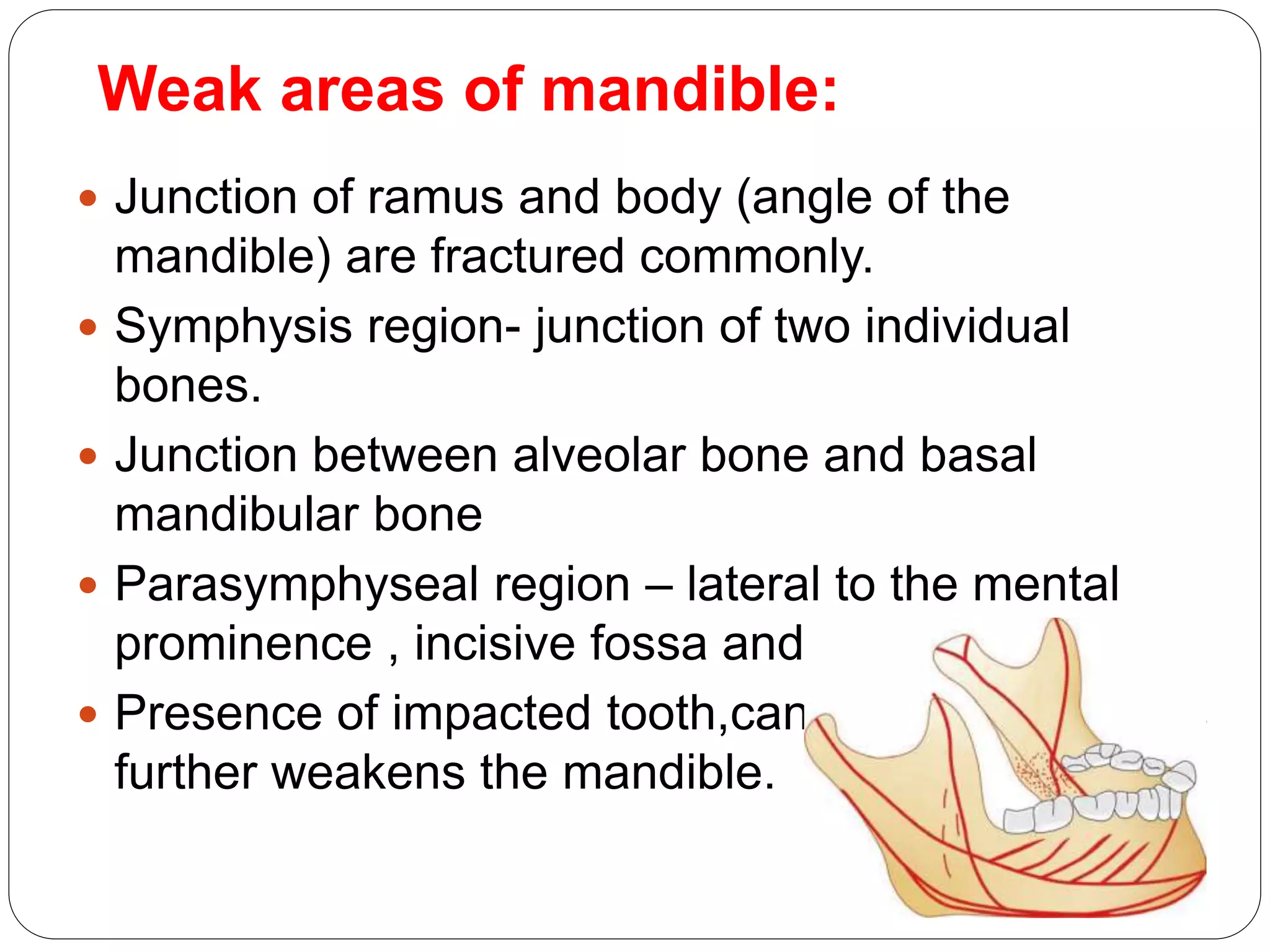 Mandibular-Fracture-1.pptx