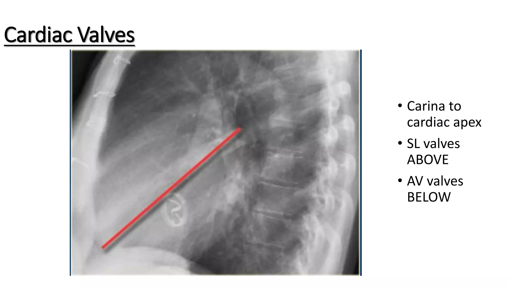409855422-CHEST-X-RAY.pptx | Heart and Cardiovascular Diseases ...