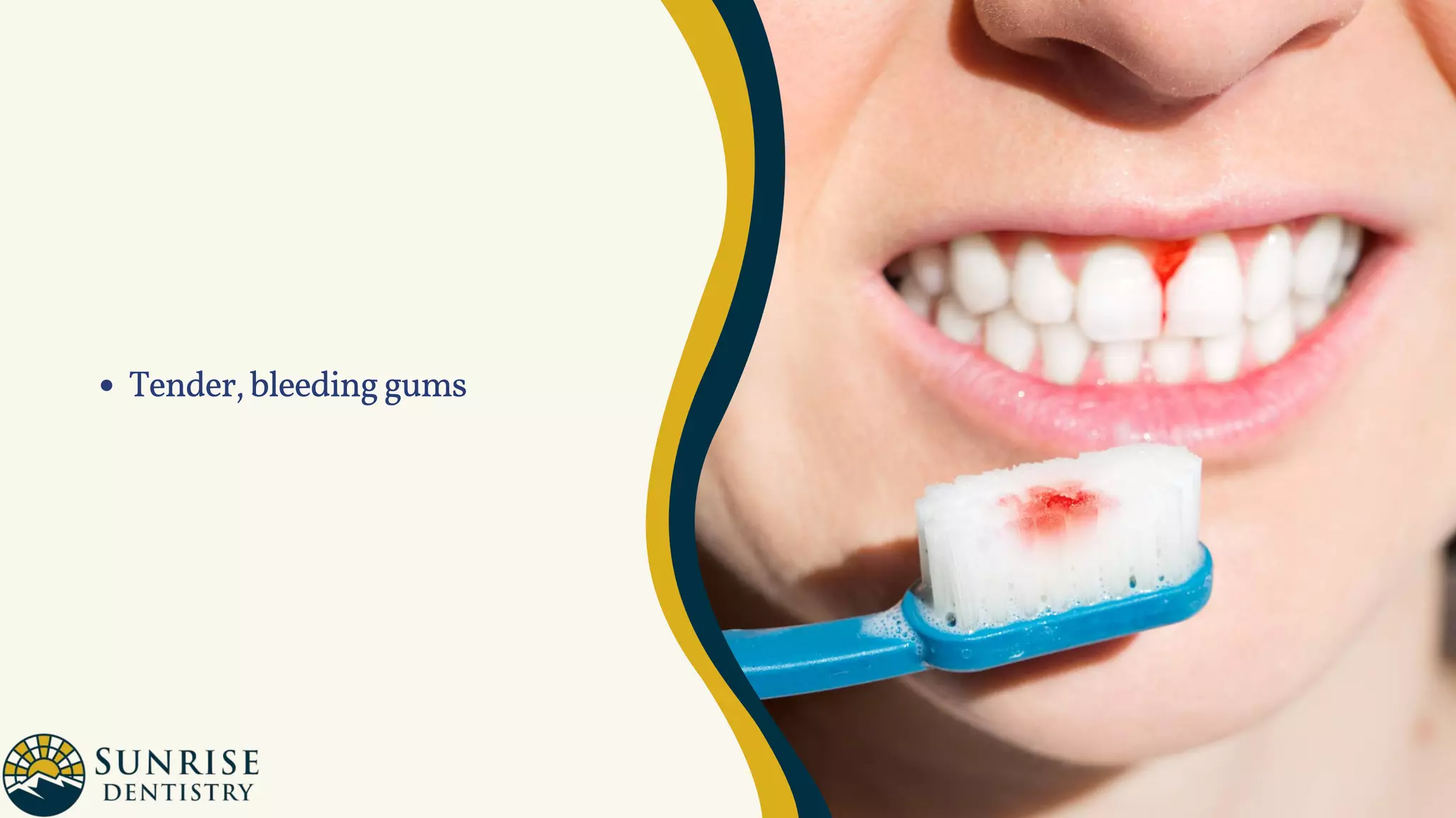 What is Happening with My Gums? Gum Disease, Bleeding, and Causes and ...