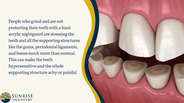 What is Happening with My Gums? Gum Disease, Bleeding, and Causes and ...