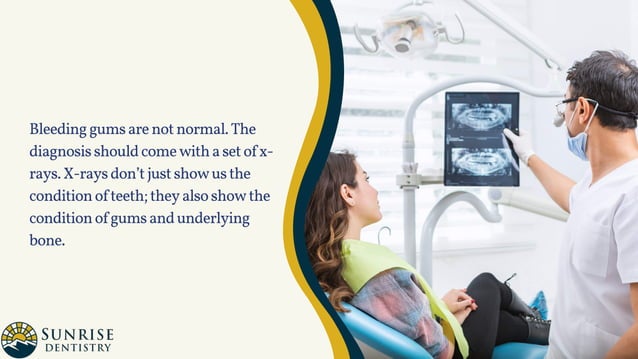 What is Happening with My Gums? Gum Disease, Bleeding, and Causes and ...