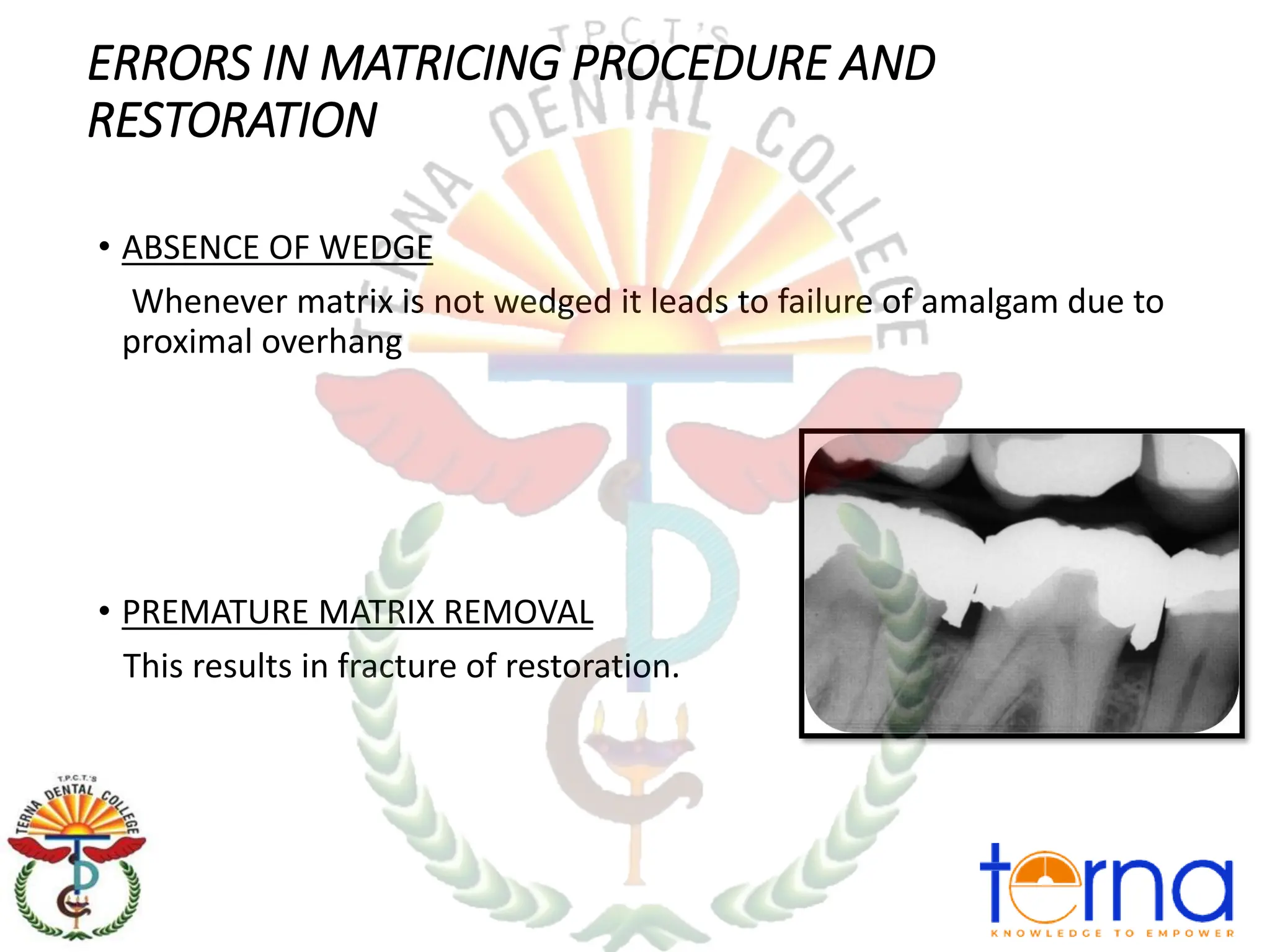 41.-amalgam-failures in restorative dentistry | PDF