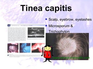 41. laboratory diagnosis of common fungal diseases | PPT
