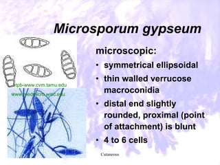41. laboratory diagnosis of common fungal diseases | PPT