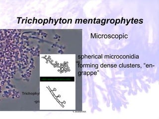 41. laboratory diagnosis of common fungal diseases | PPT
