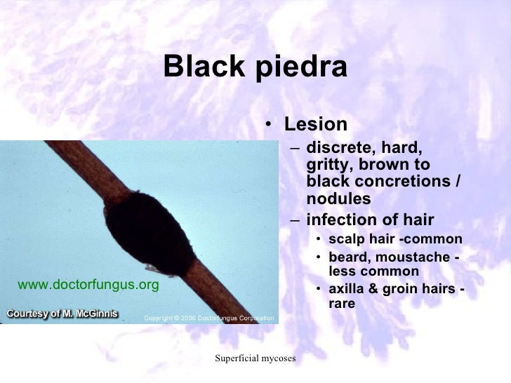 41. laboratory diagnosis of common fungal diseases