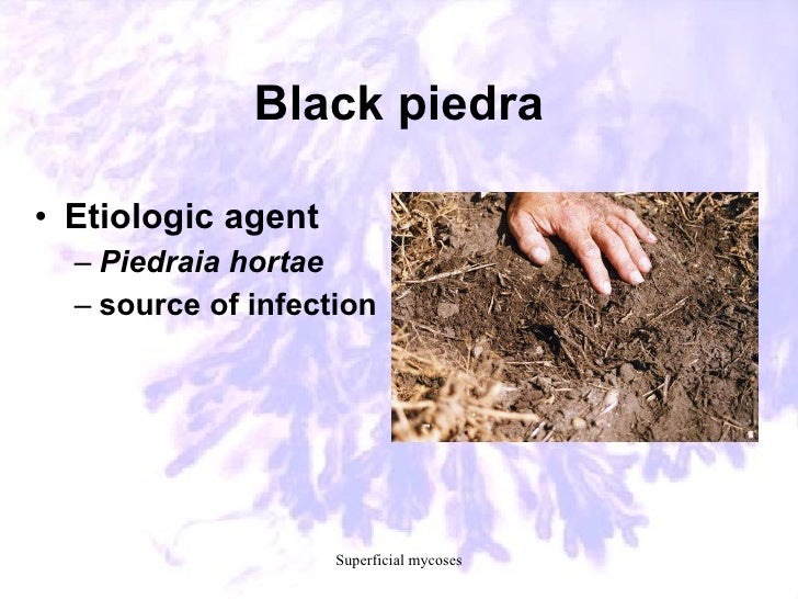 41. laboratory diagnosis of common fungal diseases