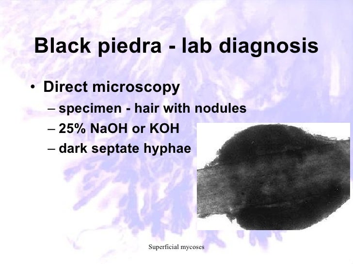 41. laboratory diagnosis of common fungal diseases