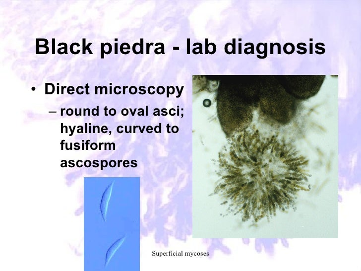41. laboratory diagnosis of common fungal diseases