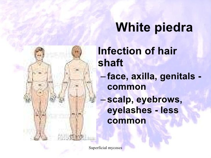 41. laboratory diagnosis of common fungal diseases