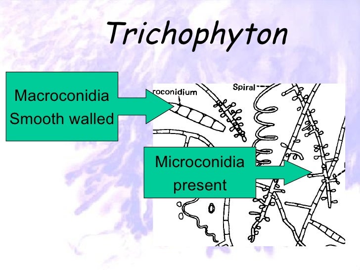 41. laboratory diagnosis of common fungal diseases