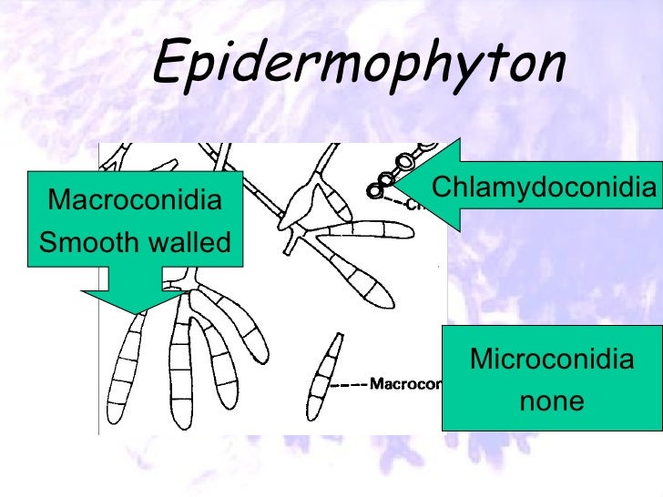 41. laboratory diagnosis of common fungal diseases
