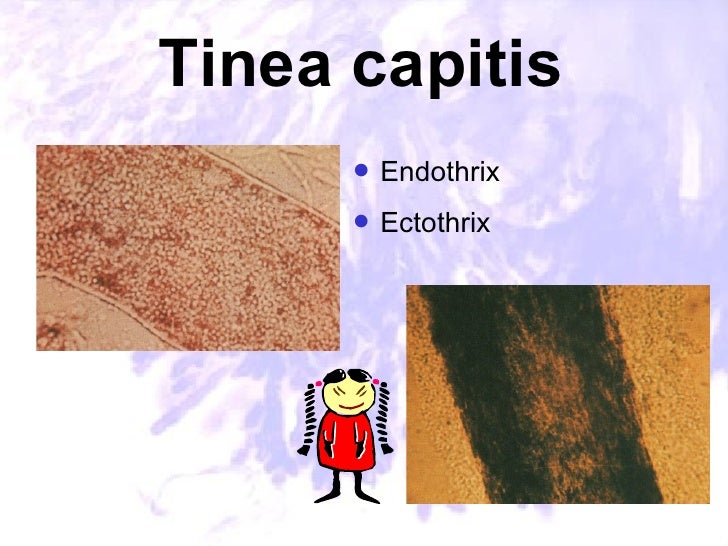 41. laboratory diagnosis of common fungal diseases