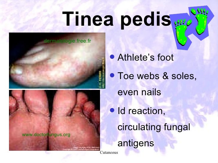41. laboratory diagnosis of common fungal diseases
