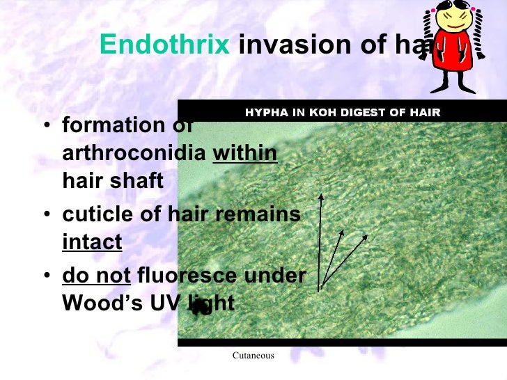 41. laboratory diagnosis of common fungal diseases