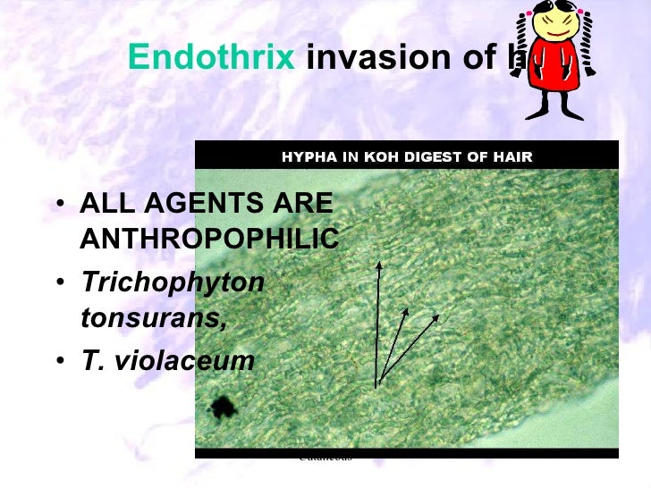 41. laboratory diagnosis of common fungal diseases