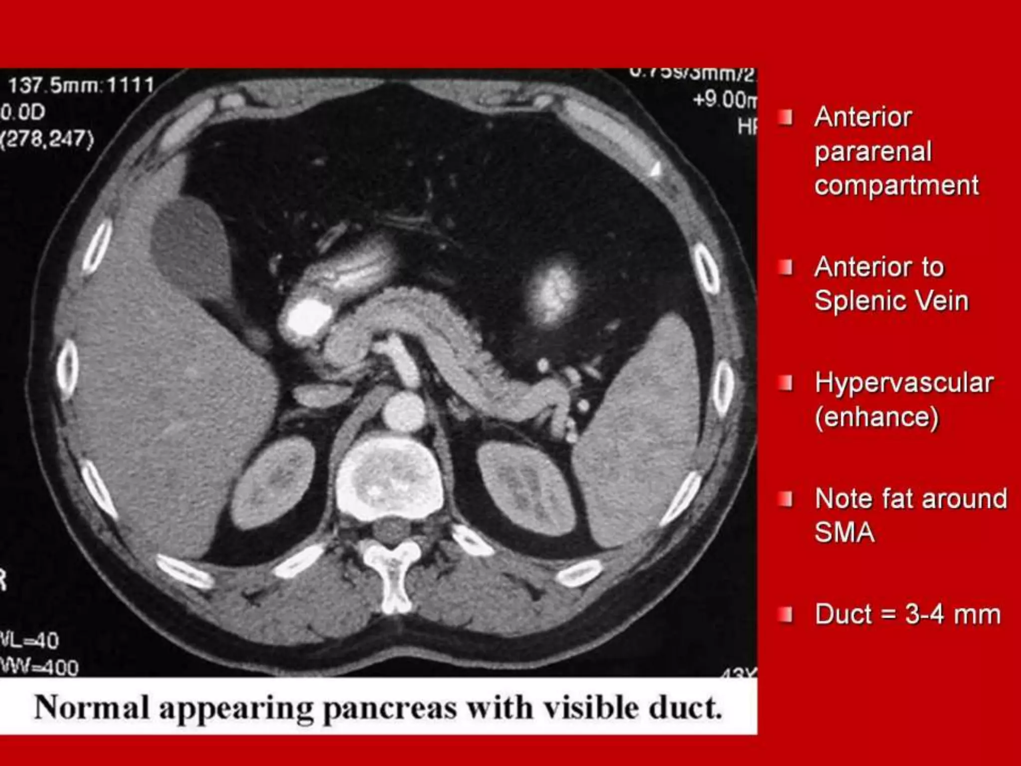 41-Dr Ahmed Esawy imaging oral board of pancreatic imaging | PPTX