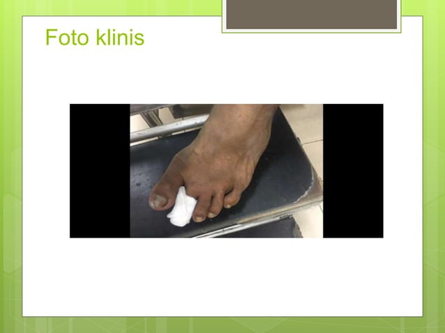 410670591-Ppt-Closed-Fraktur-digiti-III-Pedis-sinistra.pptx