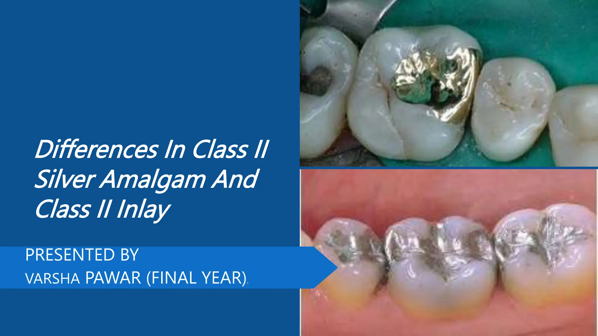 Differences-Between-Cast-Restoration-and-Amalgam[1].pptx