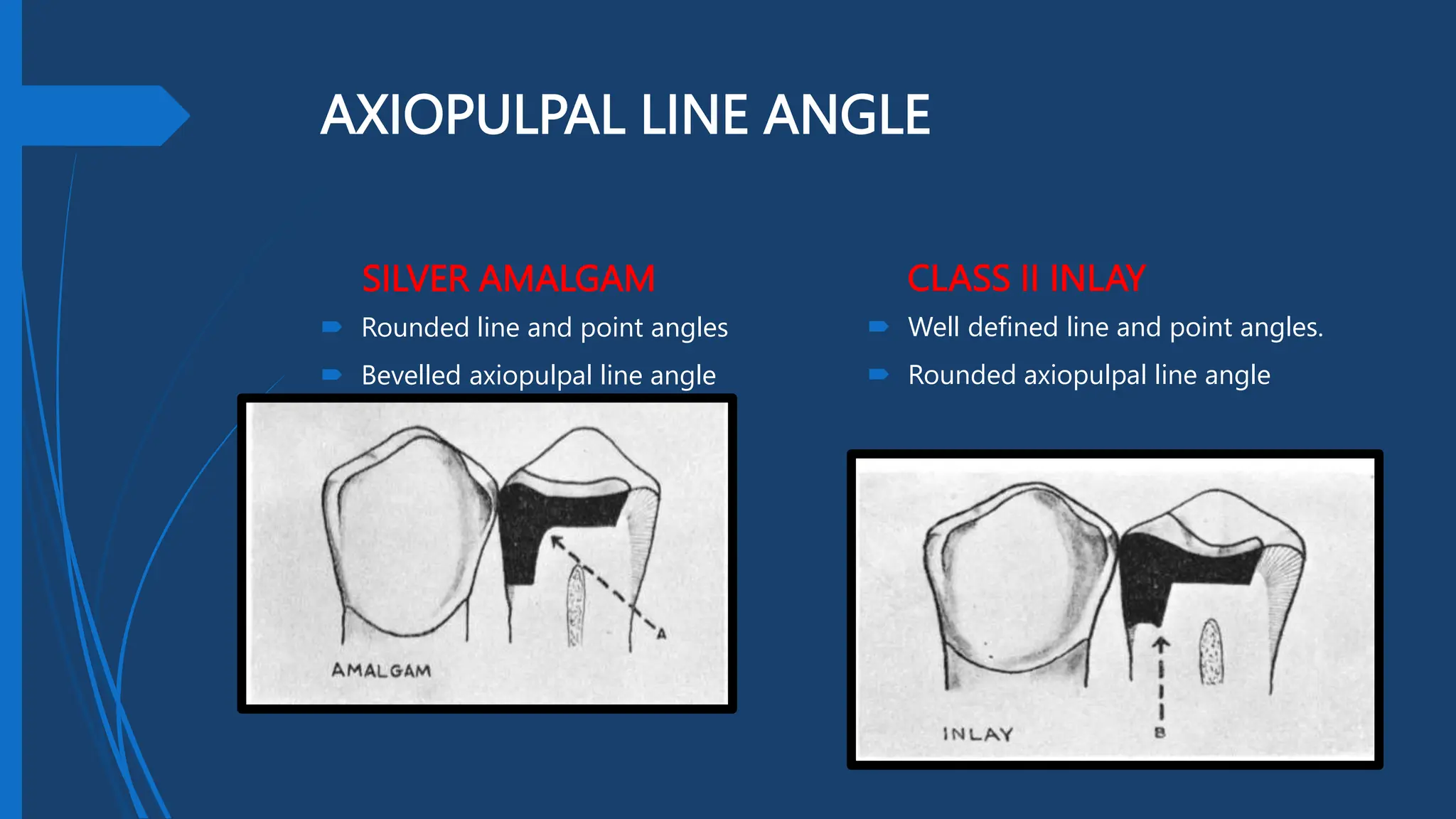 Differences-Between-Cast-Restoration-and-Amalgam[1].pptx