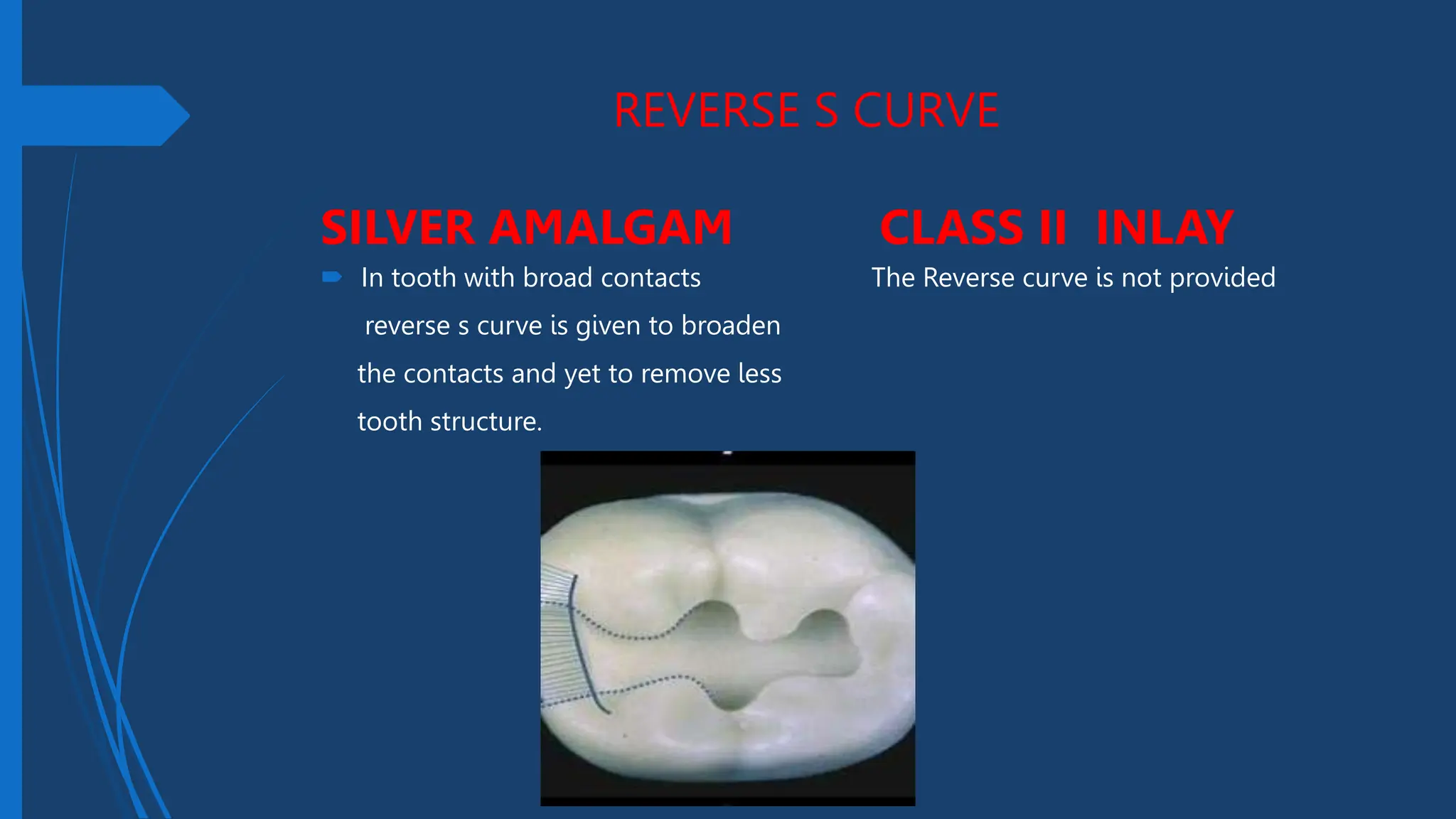 Differences-Between-Cast-Restoration-and-Amalgam[1].pptx