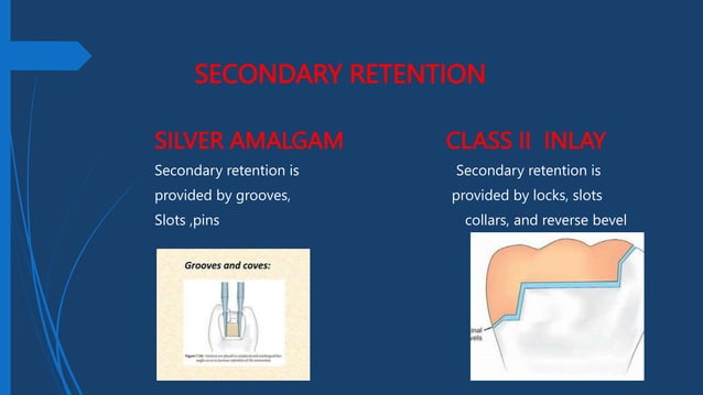 Differences-Between-Cast-Restoration-and-Amalgam[1].pptx